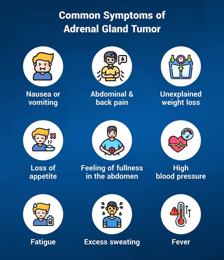 Everything You Need To Know About Adrenal Gland Tumor